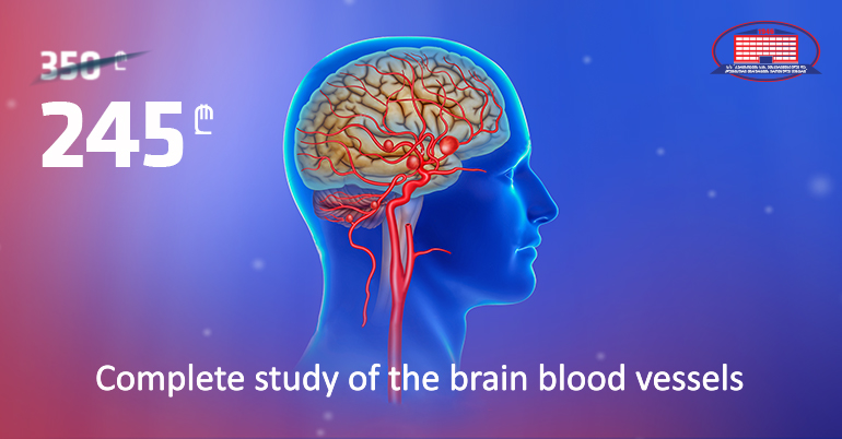 The clinic “New Life” offers a complete examination of cerebral blood ...