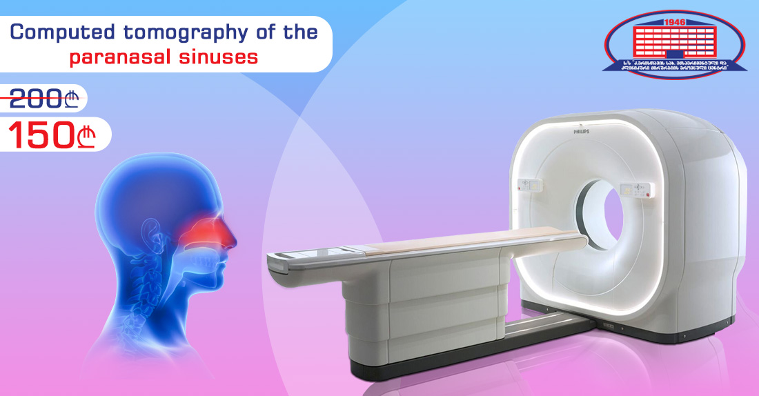 Computed tomography of the paranasal sinuses - National Surgery Center